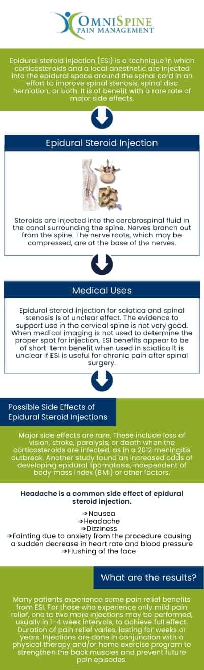 Epidural Steroid Injection (ESI) Near Me | OmniSpine