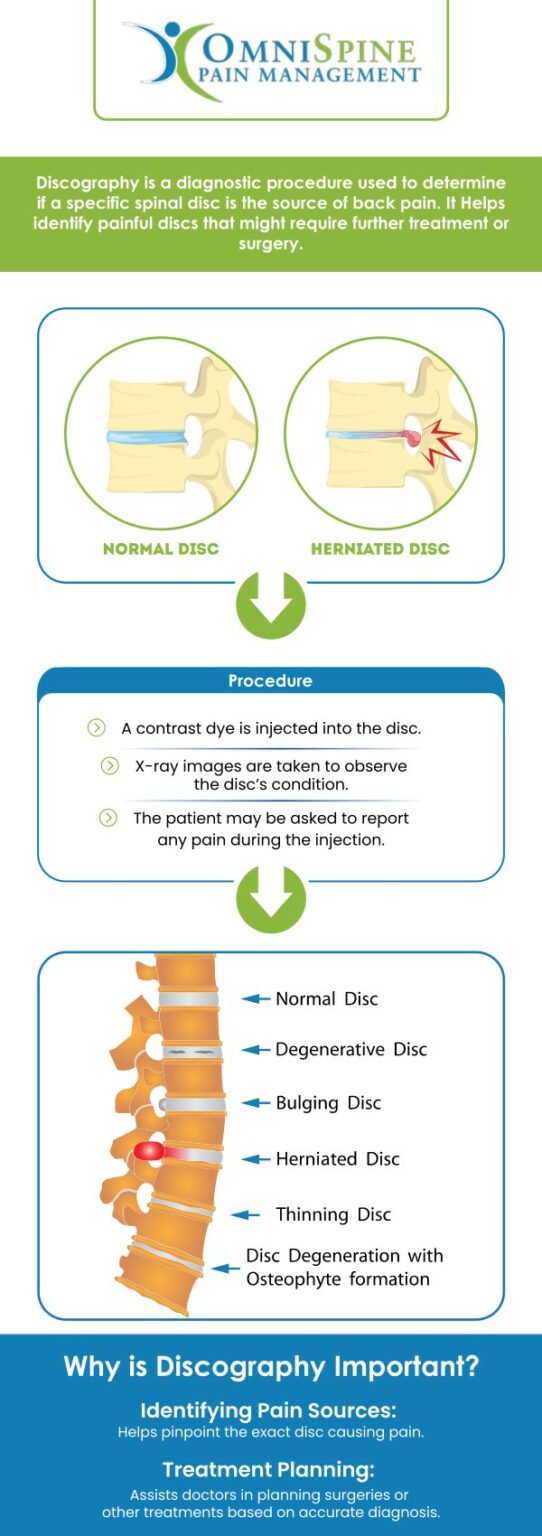 Discogram (Discography) Specialist Near Me in Texas