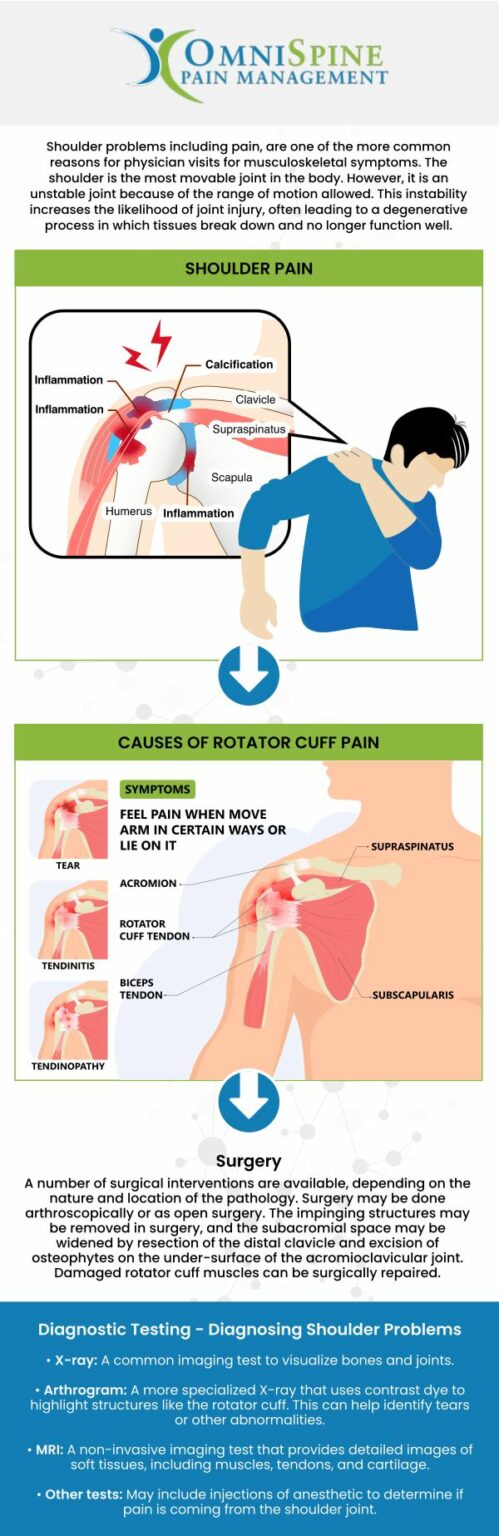 Peripheral Nerve Stimulation for Shoulder Pain | OmniSpine