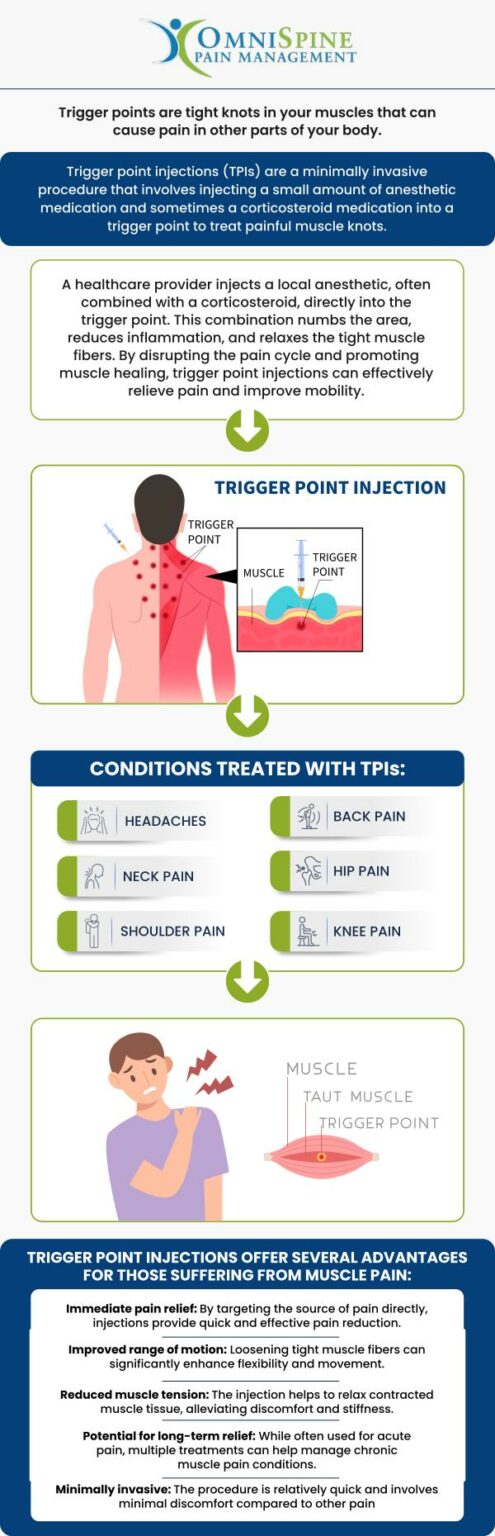 What Can I Expect From a Trigger Point Injection? | Dr Andrew